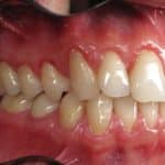 Dental Implant Specialist - Burbank Dental Implants: Ramsey Amin DDS