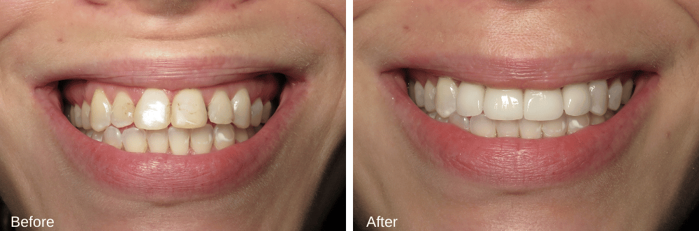Smile Gallery | Ramsey Amin, DDS