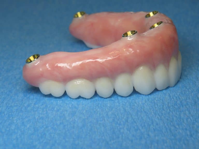 Dental Implant is Too Deep, Tooth Looks Long