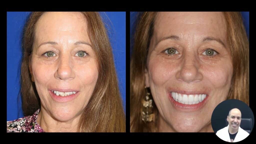 The Ovate Pontic – Ramsey Amin DDS of Burbank Explains This Dental ...