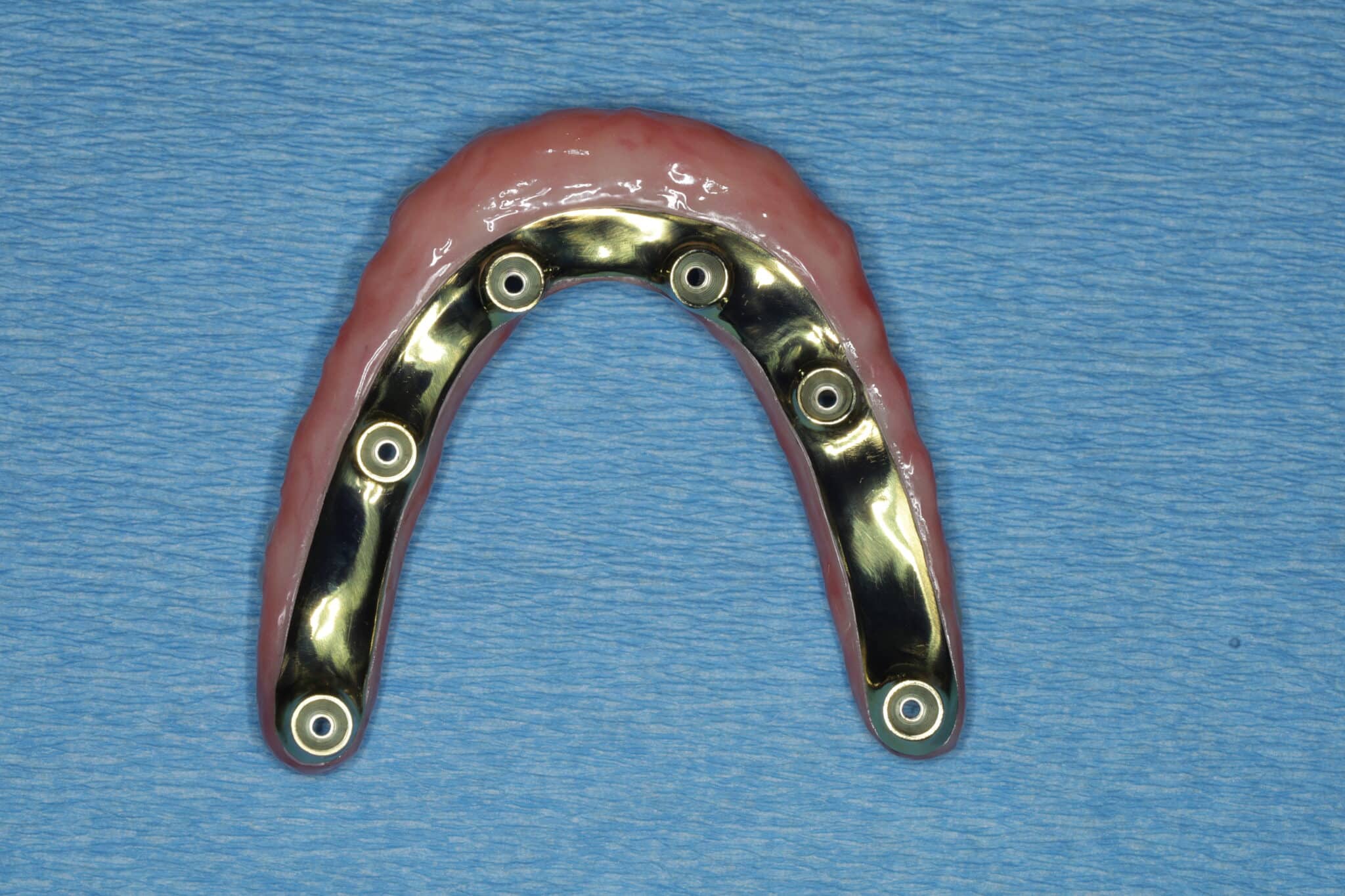 Is It Normal? Extraction Bone Graft Membrane (White) Showing