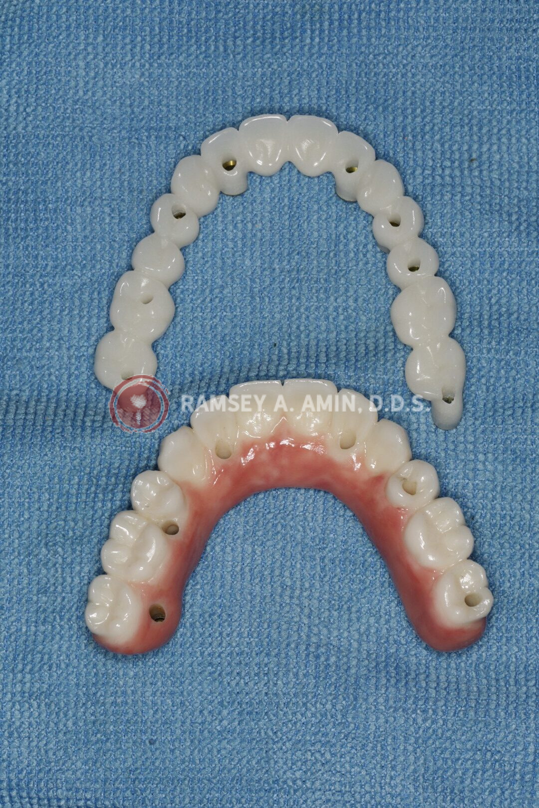 Dental Implants With No Gums or With Fake Pink Gums - Dr. Amin
